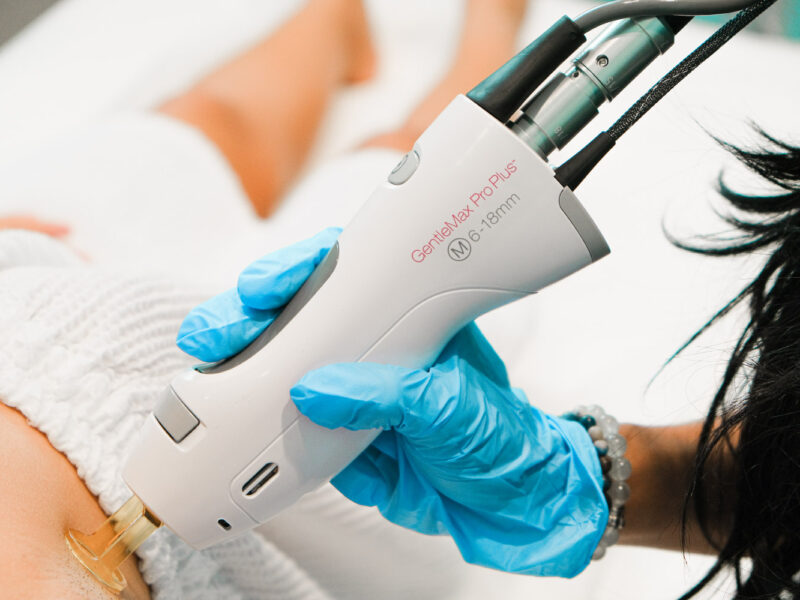 從傳統到現代：GentleMax Pro Plus 脫毛技術的全新體驗 - Yanis Beauty